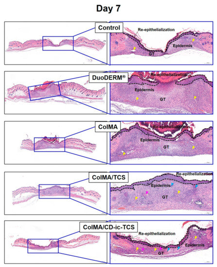 Visible Light-Cured Antibacterial Collagen Hydrogel Containing Water ...