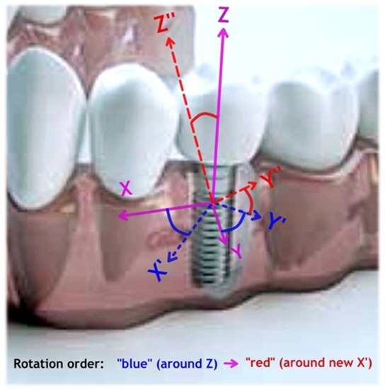 Materials | Free Full-Text | Biomechanical Properties of Bone and ...