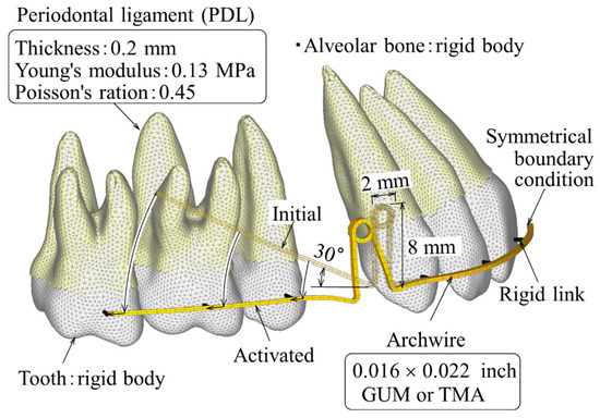 Tooth Movement Efficacy of Retraction Spring Made of a New Low Elastic ...