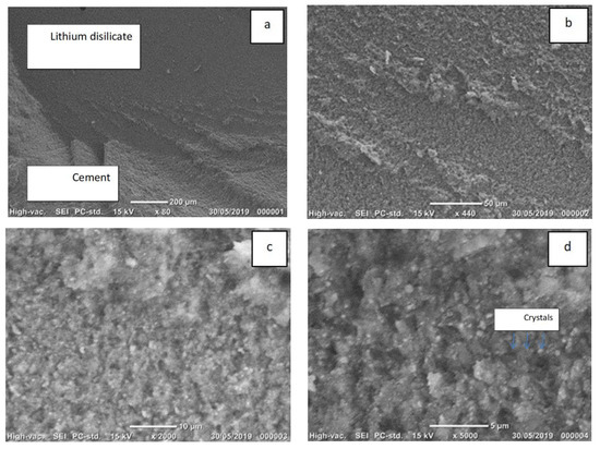 Materials | Free Full-Text | Effect of Different Surface Treatments of ...