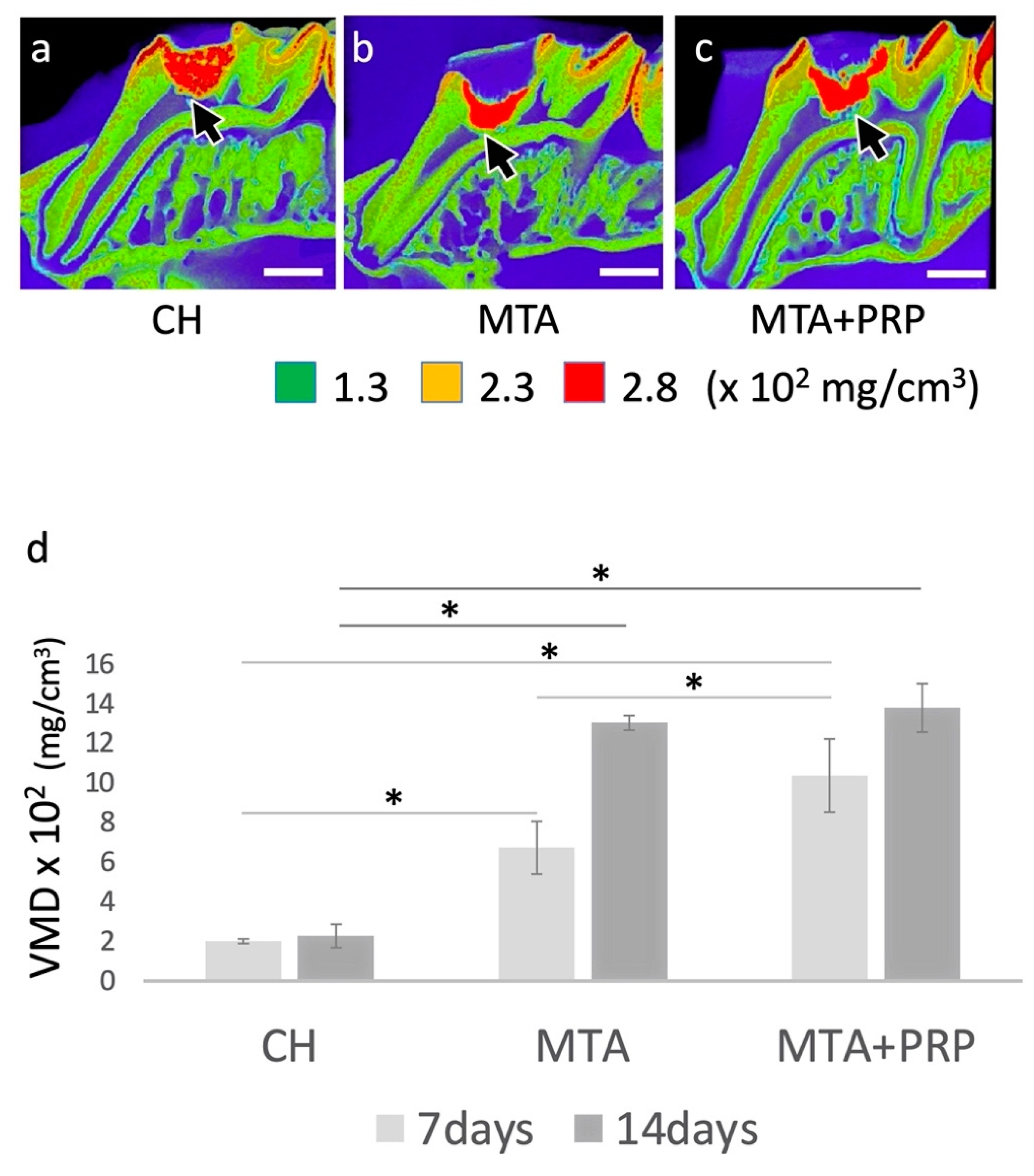Mineral Trioxide Aggregate (MTA) Upregulates the Expression of DMP1 in ...