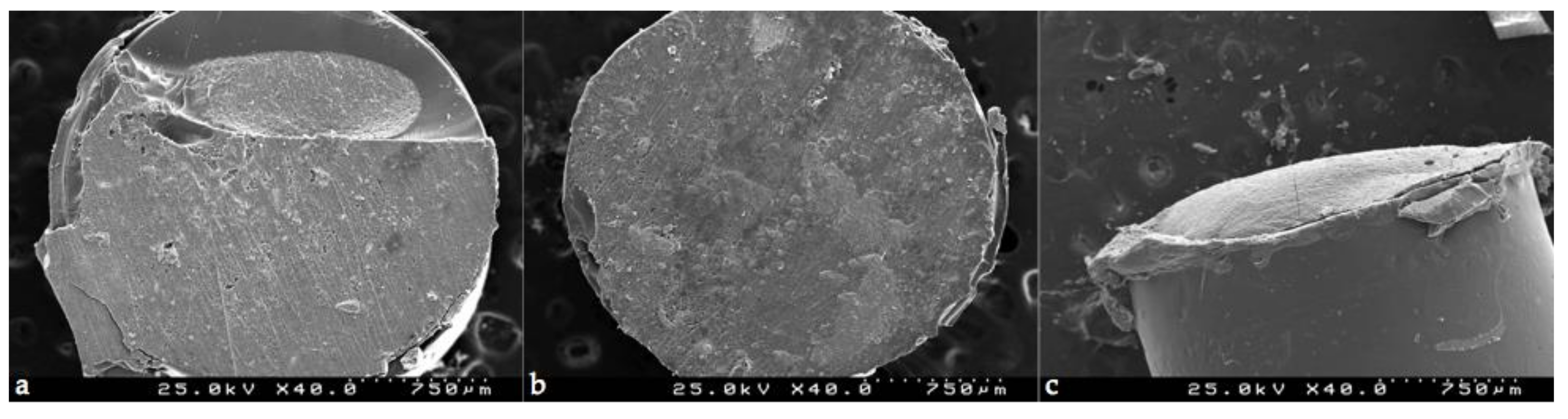 Evaluation of the Interfaces between Restorative and Regenerative ...