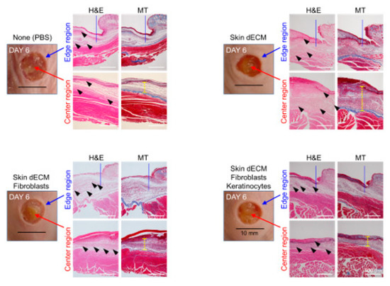Therapeutic Efficacy of Artificial Skin Produced by 3D Bioprinting