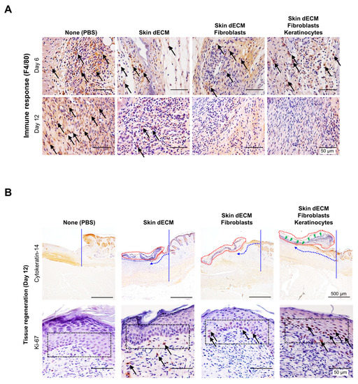 Therapeutic Efficacy of Artificial Skin Produced by 3D Bioprinting