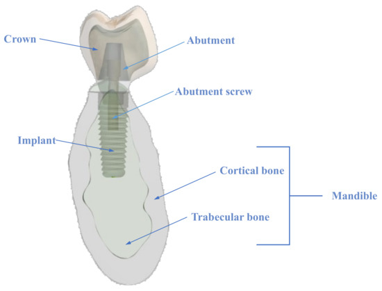 Trabecular Bone Tooth
