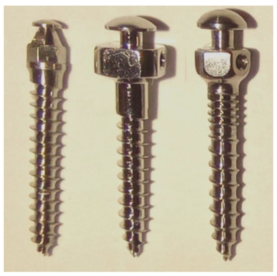 Effect of Microimplant Neck Design with and without Microthread on ...