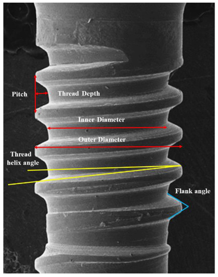 Effect of Microimplant Neck Design with and without Microthread on ...