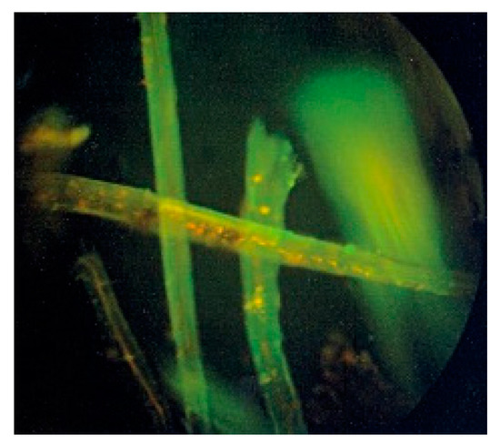 Bioactive Hemp Clothing Modified with Cannabidiol (CBD) Cannabis sativa ...