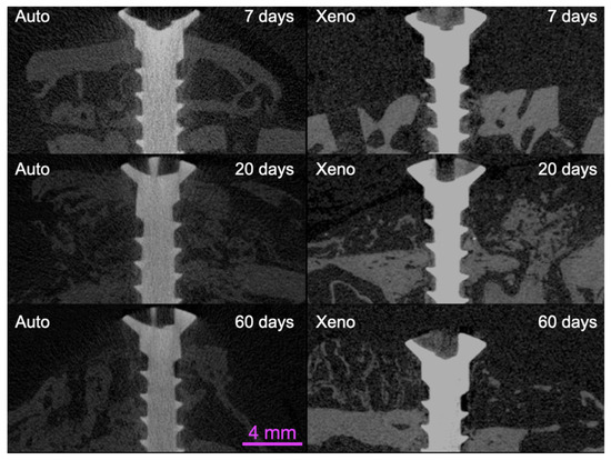 Materials | Free Full-Text | Histomorphometric, Immunohistochemical and ...