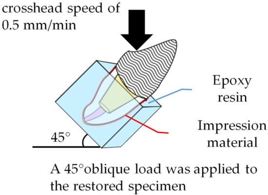 Fabricated CAD/CAM Post-Core Using Glass Fiber-Reinforced Resin Shows ...