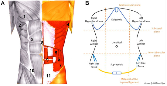 Intertubercular Plane