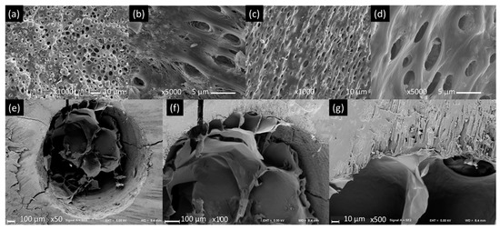 Evaluation of Injectable Hyaluronic Acid-Based Hydrogels for Endodontic ...