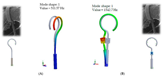 Numerical Analysis of Stapes Prosthesis Constraining in the Case of ...