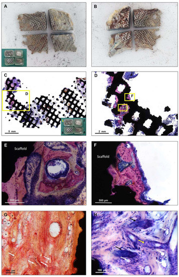 Histological Processing of CAD/CAM Titanium Scaffold after Long-Term ...