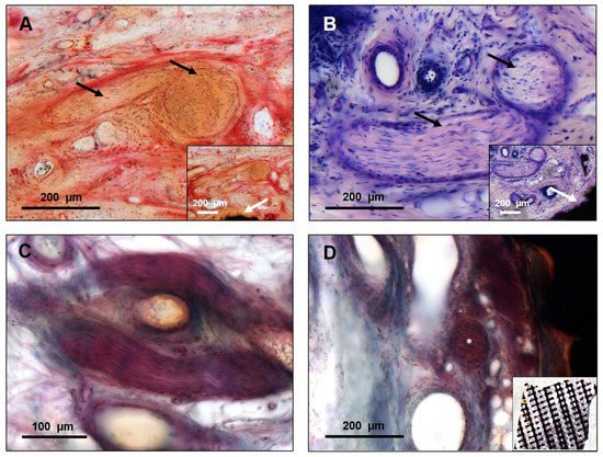 Histological Processing of CAD/CAM Titanium Scaffold after Long-Term ...