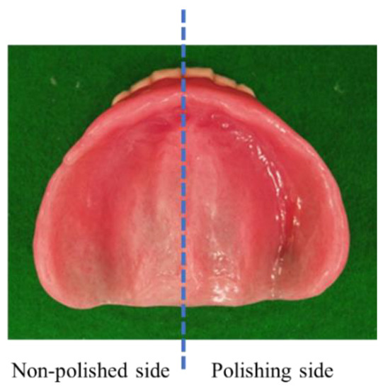 Impact of Surface Changes and Microbial Adhesion on Mucosal Surface ...
