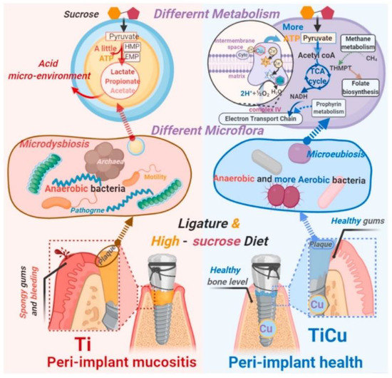 Recent Advances in Copper-Doped Titanium Implants