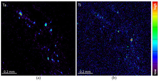 Total Knee Replacement with an Uncemented Porous Tantalum Tibia ...