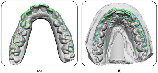 Evaluation of Tooth Movement Accuracy with Aligners: A Prospective Study