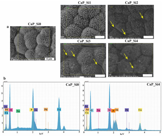 Materials | Free Full-Text | PCL/Si-Doped Multi-Phase Calcium Phosphate Scaffolds Derived from ...