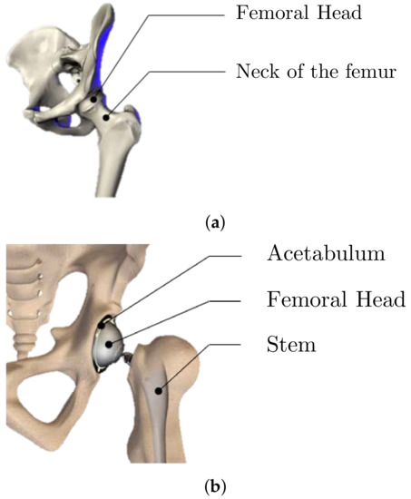 Simulation-Based Process Design for Asymmetric Single-Point Incremental ...