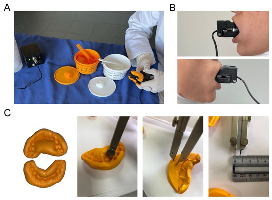A Low-Cost Wireless Bite Force Measurement Device