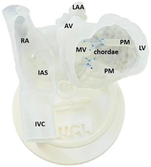 Demonstration of Use of a Novel 3D Printed Simulator for Mitral Valve ...
