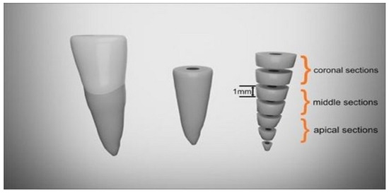Evaluation of Bond Strength of Four Different Root Canal Sealers