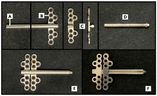 A Novel Alveolar Distractor Incorporating Nickel–Titanium Alloy Springs ...