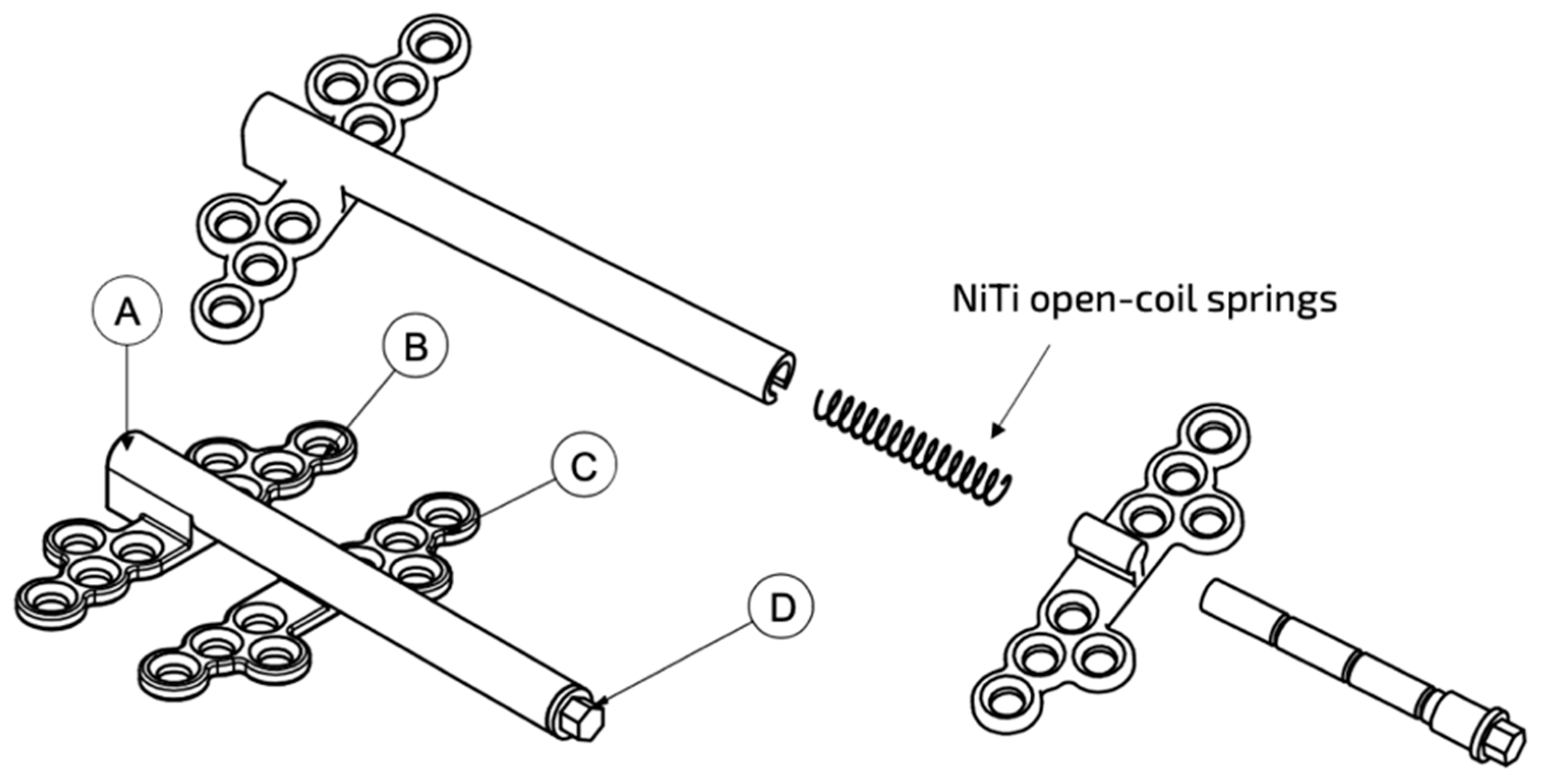 A Novel Alveolar Distractor Incorporating Nickel–Titanium Alloy Springs ...