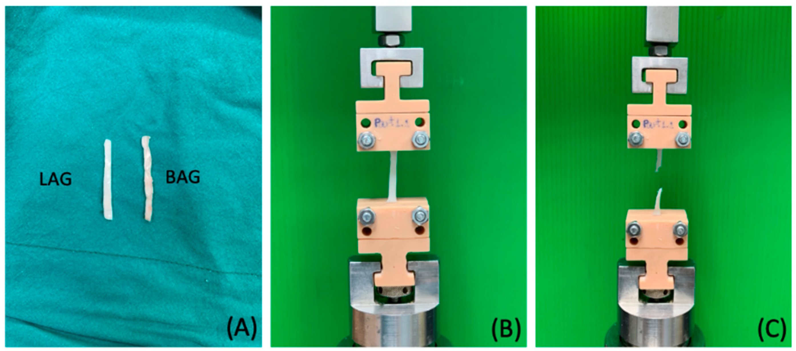 A Novel Alveolar Distractor Incorporating Nickel–Titanium Alloy Springs ...