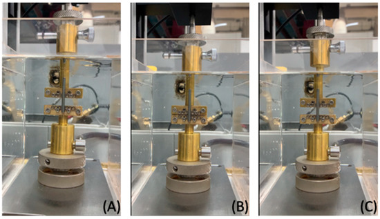 A Novel Alveolar Distractor Incorporating Nickel–Titanium Alloy Springs ...