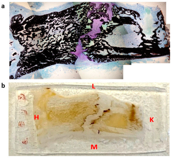 Mechanical Characterization at the Microscale of Mineralized Bone ...