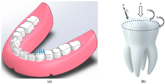 Materials | Free Full-Text | Algorithm for Designing a Removable ...