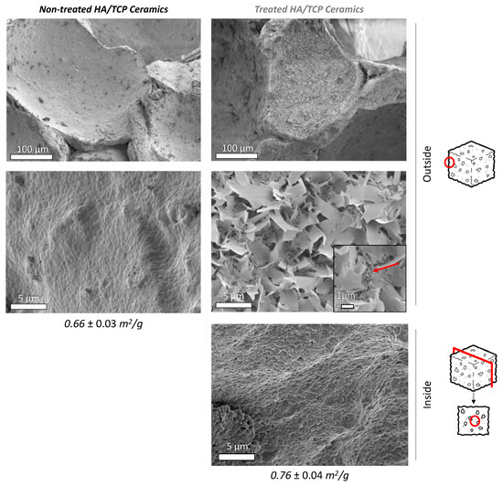 Bio-Activation of HA/β-TCP Porous Scaffolds by High-Pressure CO2 ...