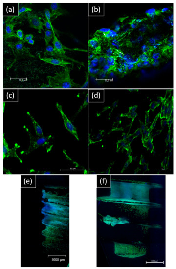 Comparison of the Biological Behavior and Topographical Surface ...