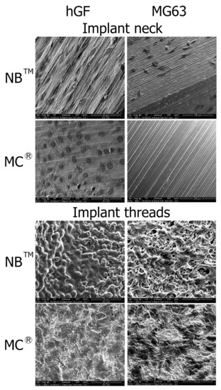 Comparison of the Biological Behavior and Topographical Surface ...