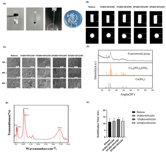 Structure and Properties of Bioactive Glass-Modified Calcium Phosphate ...