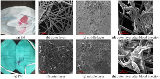 Prolonged Use of Surgical Masks and Respirators Affects the Protection ...