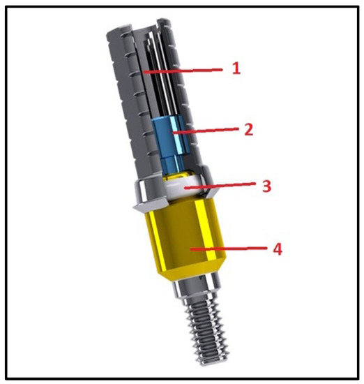 Evaluation of Load Distribution in a Mandibular Model with Four ...
