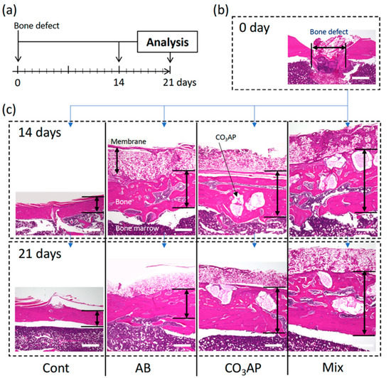 Synergistic Effect of Carbonate Apatite and Autogenous Bone on Osteogenesis