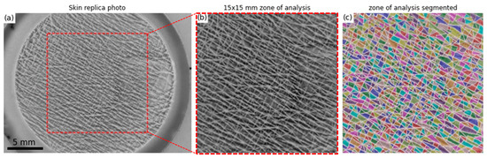 Quantification of Microstructural Changes in the Dermis of Elderly ...