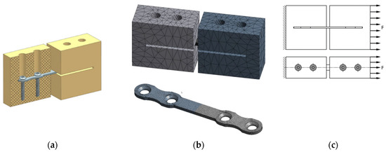 Strength of Products Made of Ultrafine-Grained Titanium for Bone ...