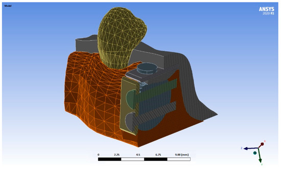 A Biomechanical Analysis of the Influence of the Morfology of the Bone ...