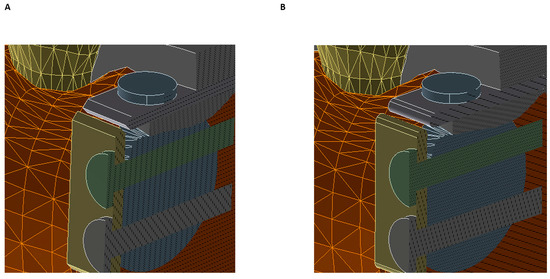 A Biomechanical Analysis of the Influence of the Morfology of the Bone ...