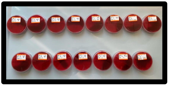 Aesthetic Restorations: The Role of The Dental Hygienist in ...