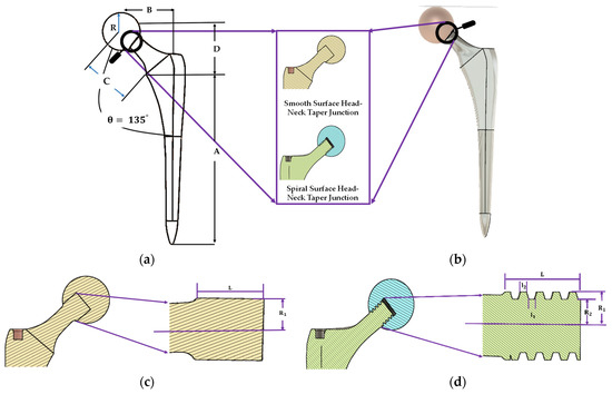 Design and Performance Evaluation of a Novel Spiral Head-Stem Trunnion for Hip Implants Using ...