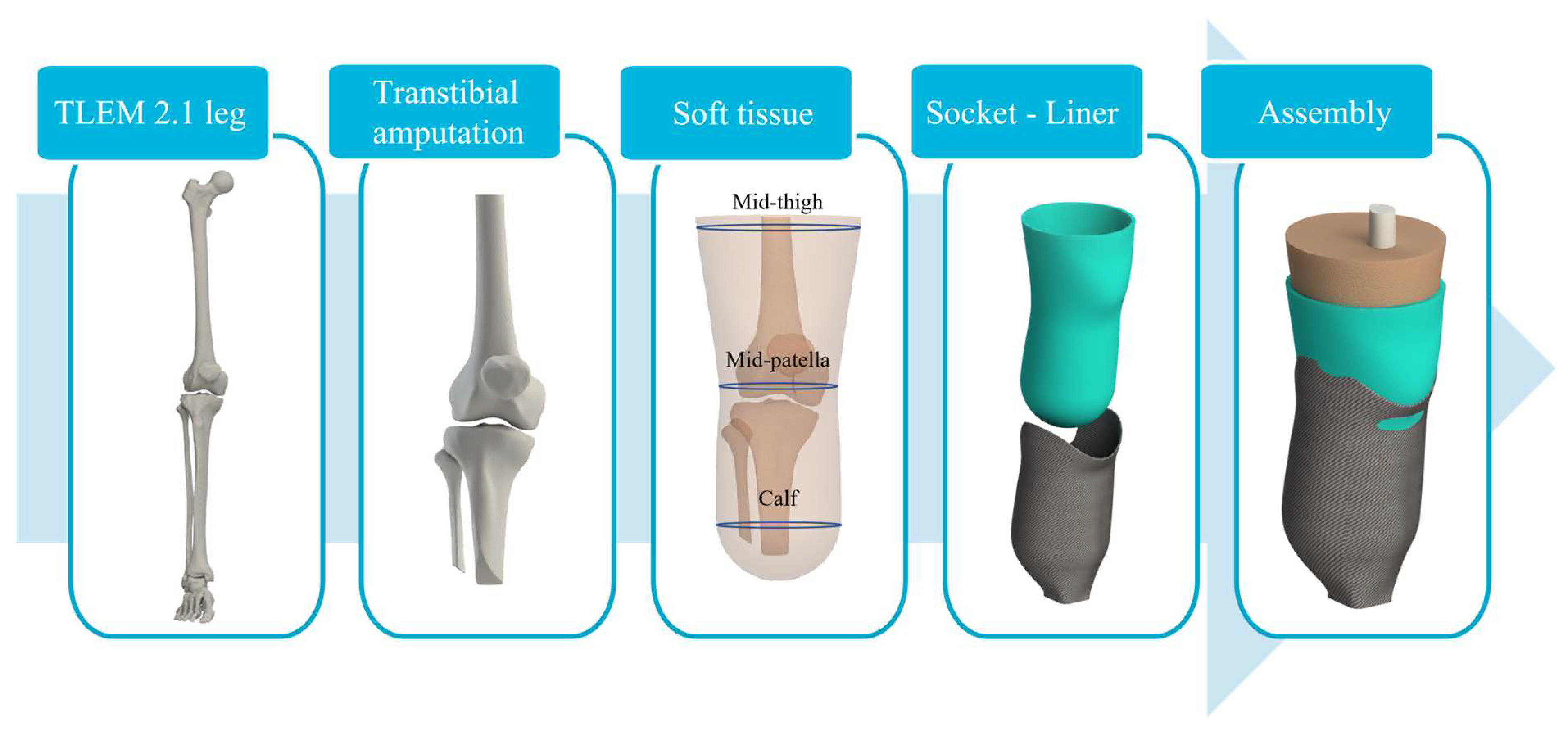 Numerical Analysis of a Transtibial Prosthesis Socket Using 3D-Printed Bio-Based PLA