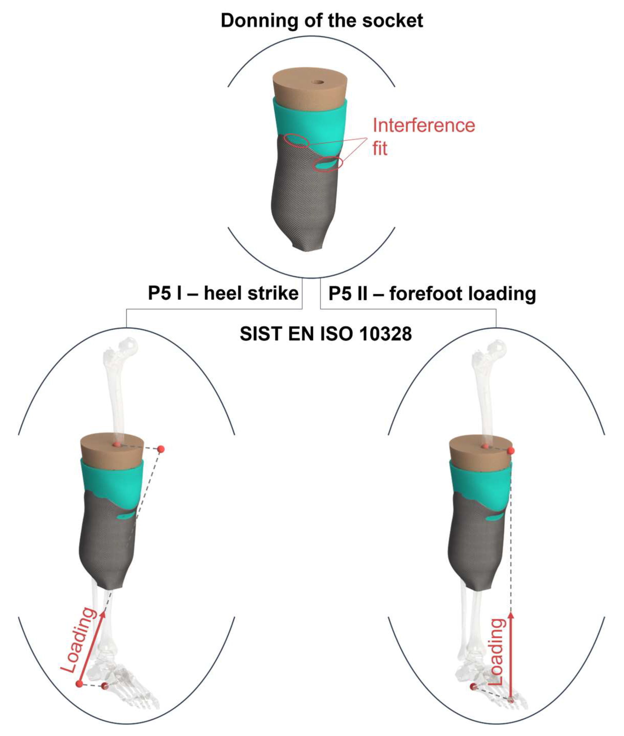 Materials | Free Full-Text | Numerical Analysis of a Transtibial Prosthesis Socket Using 3D ...
