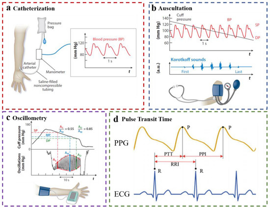 Wearable Continuous Blood Pressure Monitoring Devices Based on Pulse ...